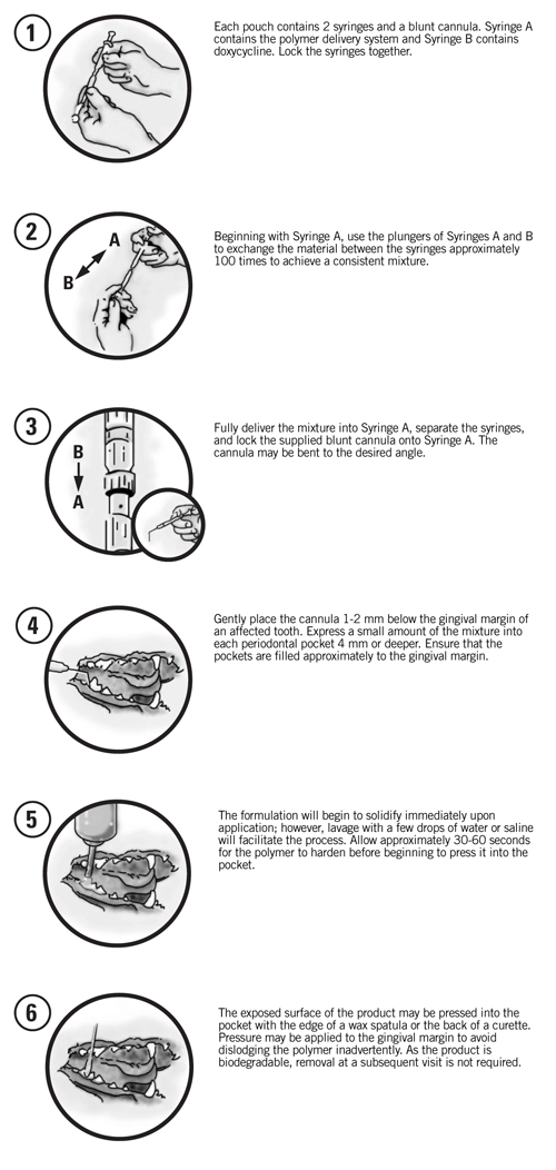 treatment and control of periodontal disease requires a comprehensive ...